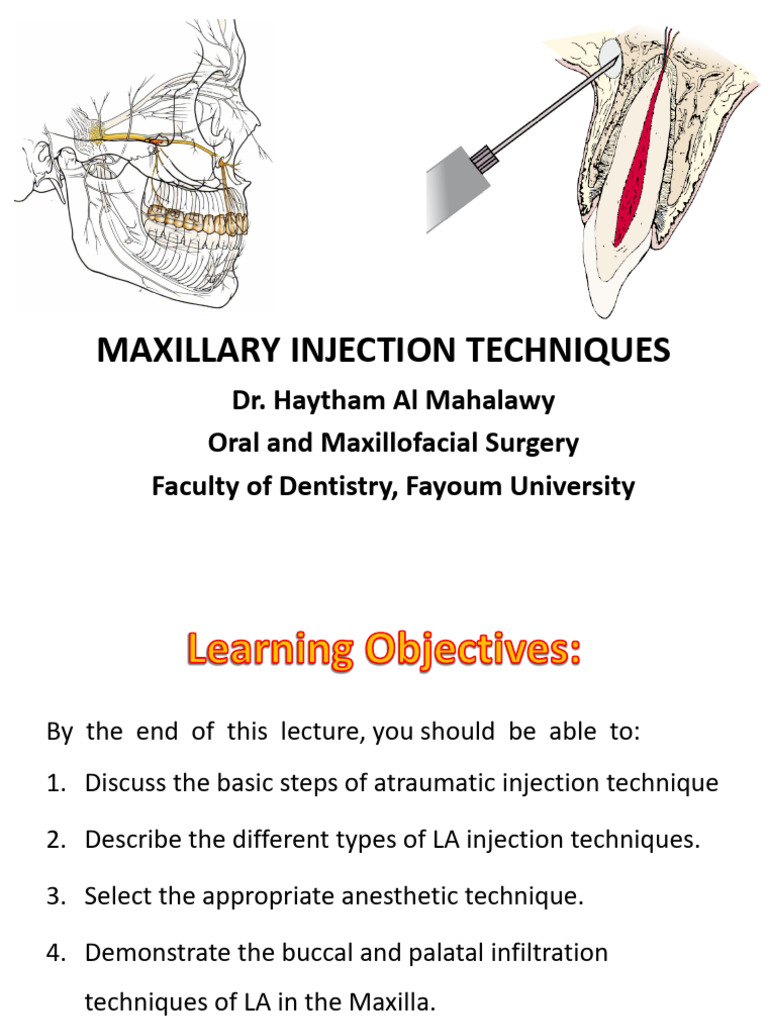 maxillary injection techniques-1 | Download Free PDF | Injection ...