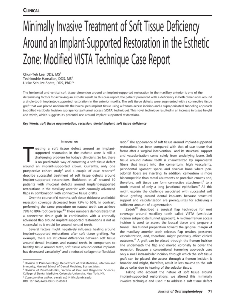Vista Ioi | Download Free PDF | Dental Implant | Periodontology