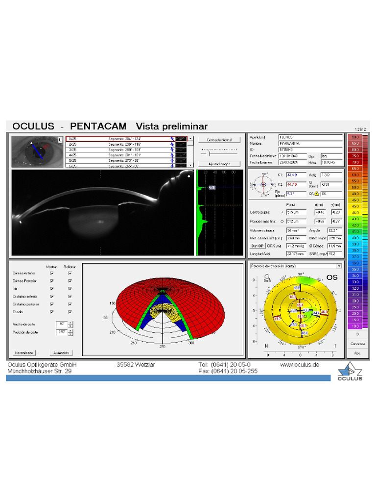 HC409437-Pentacam OI-20240326-101333-0002 | PDF