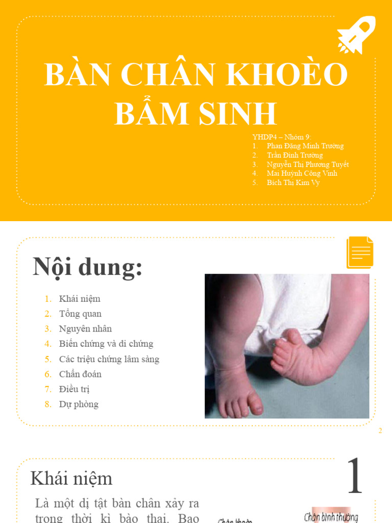 Bàn Chân Khoèo PP | PDF