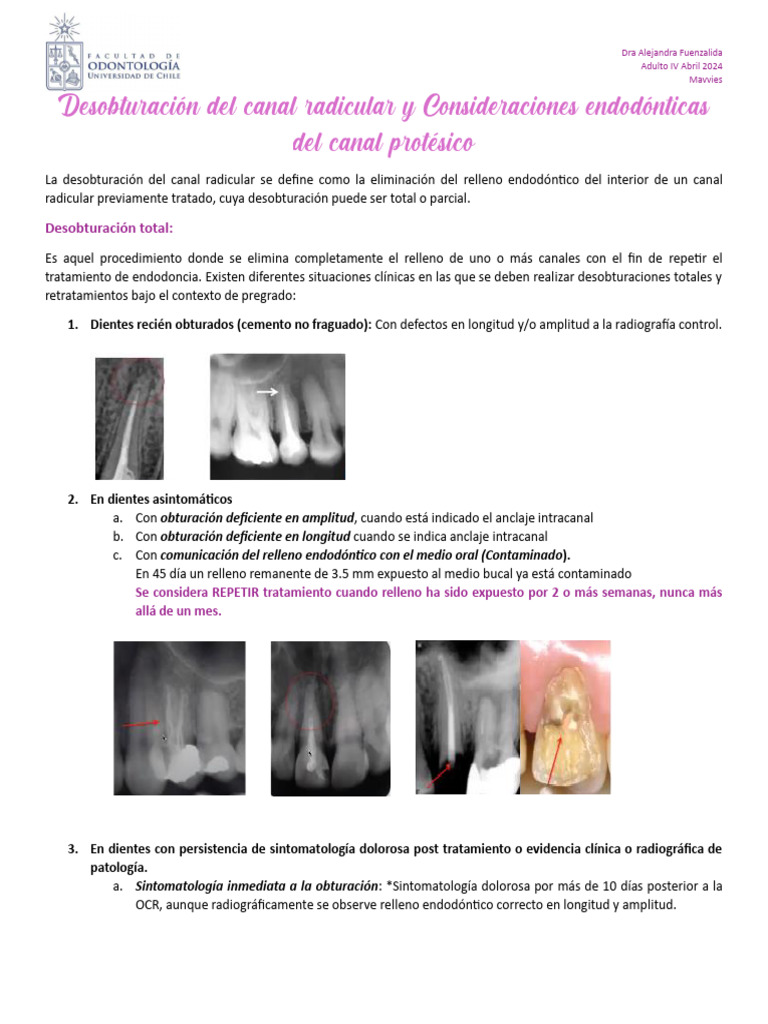 1.Desobturación del canal radicular y Consideraciones endodónticas del ...