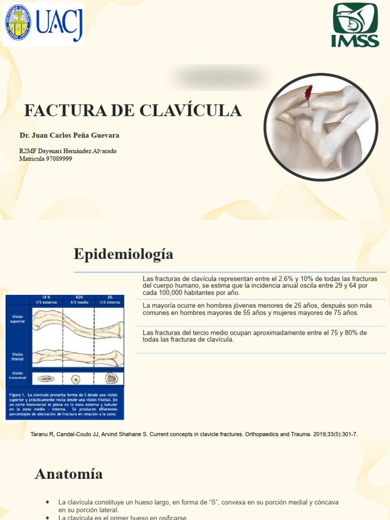 Clasificación de Fracturas de Clavícula | PDF | Hombro | Articulaciones