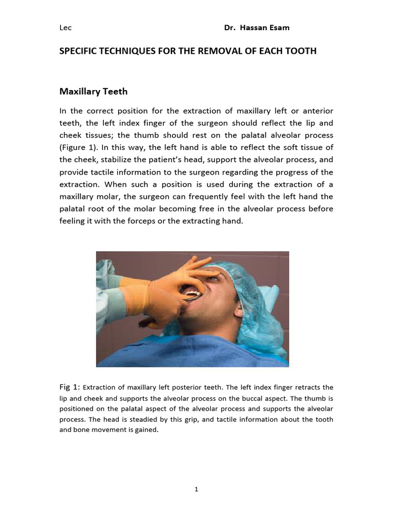 Oral Surgery Lec. 5 | PDF | Tooth | Human Tooth