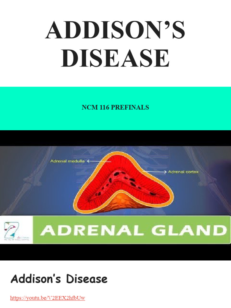 Addisons Disease | PDF | Adrenal Gland | Cortisol