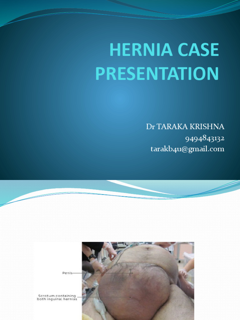 Hernia 2 | Download Free PDF | Anatomy