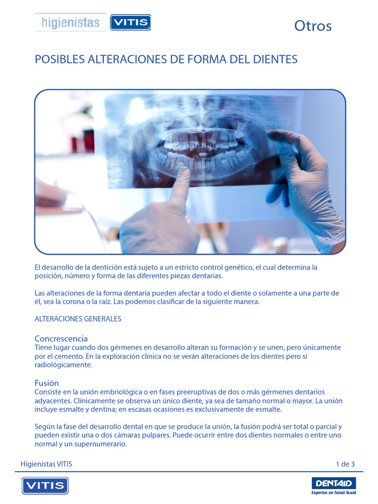 Alteraciones de Forma | PDF | Diente | Esmalte de dientes