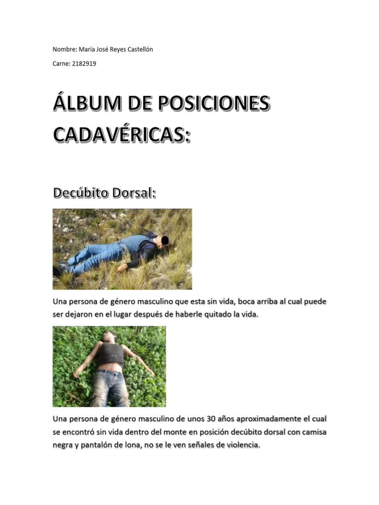 Album Posiciones Cadavericas | PDF