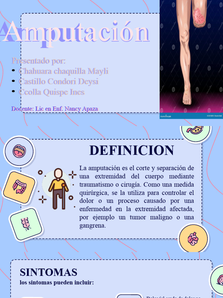 AMPUTACION | PDF | Hueso | Cirugía