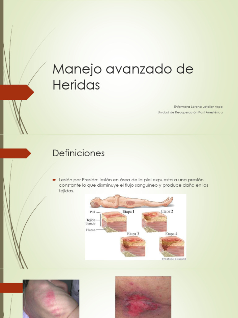 Manejo Avanzado de Heridas | Descargar gratis PDF | Herida | Especialidades Medicas