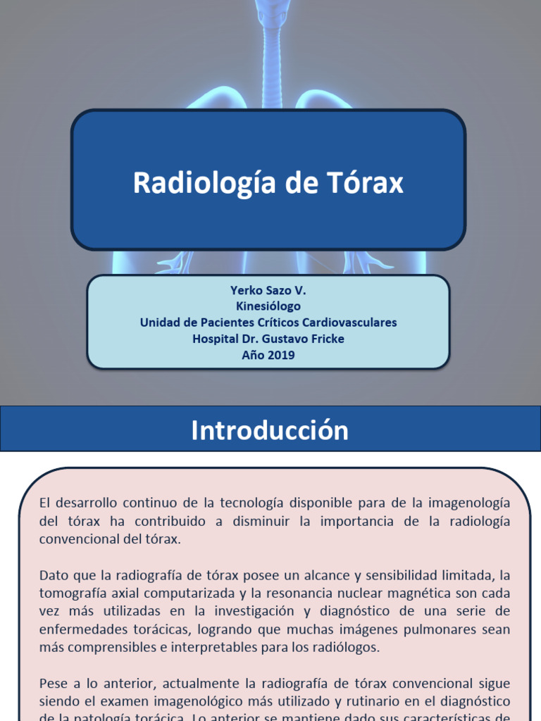 Radiología de Tórax | PDF | Pulmón | Radiología