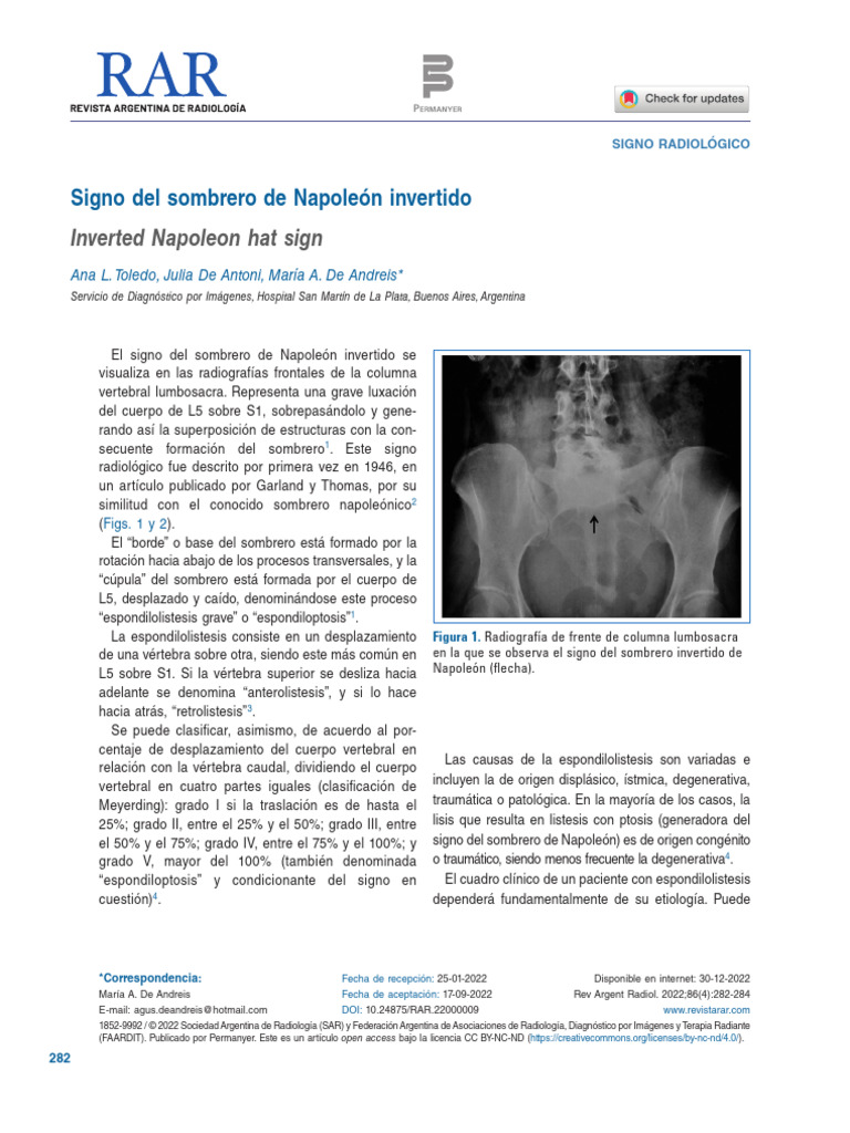 Signo Del Sombrero de Napoleón Invertido | PDF | Medicina CLINICA ...