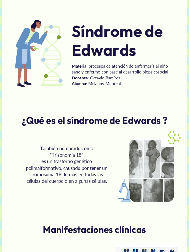 Sindrome de Edwards | PDF | Enfermedades y trastornos | Causas de la muerte