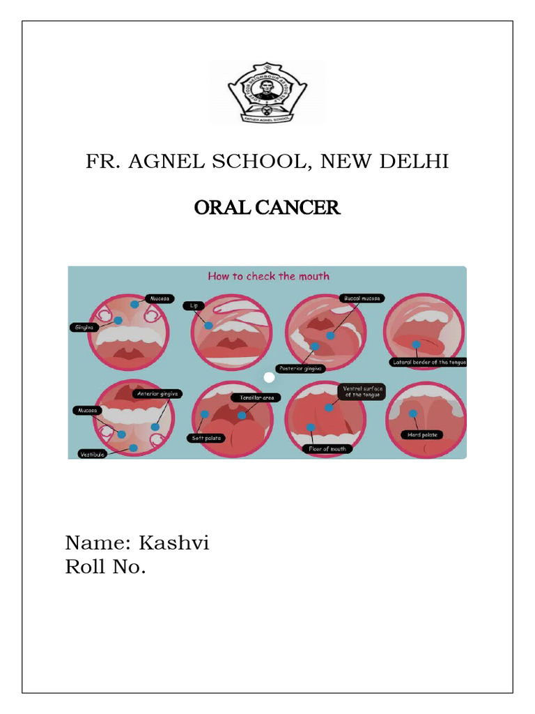 Biology Project ORAL CANCER | PDF | Cancer | Chemotherapy