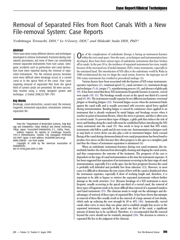 2006 - Removal of Separated Files From Root Canals With A New File ...