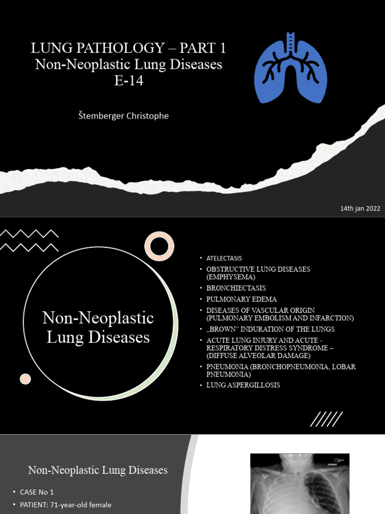 Non-Neoplastic Lung Diseases Overview | PDF | Respiratory Diseases ...
