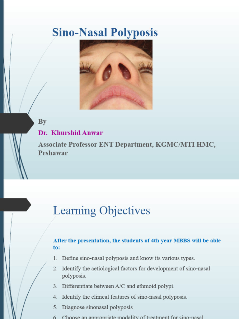 Sino-Nasal Polyposis For 4th Year MBBS | PDF | Human Nose ...