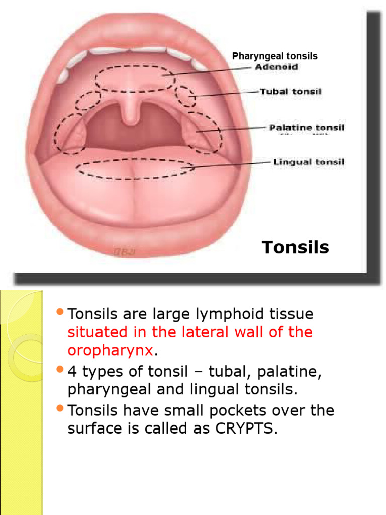 Tonsilitis | PDF | Inflammation | Medical Specialties