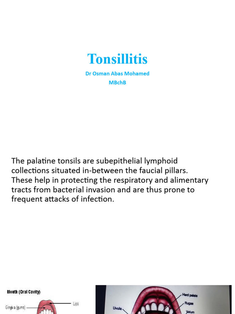 5 Tonsillitis | Download Free PDF | Infection | Surgery