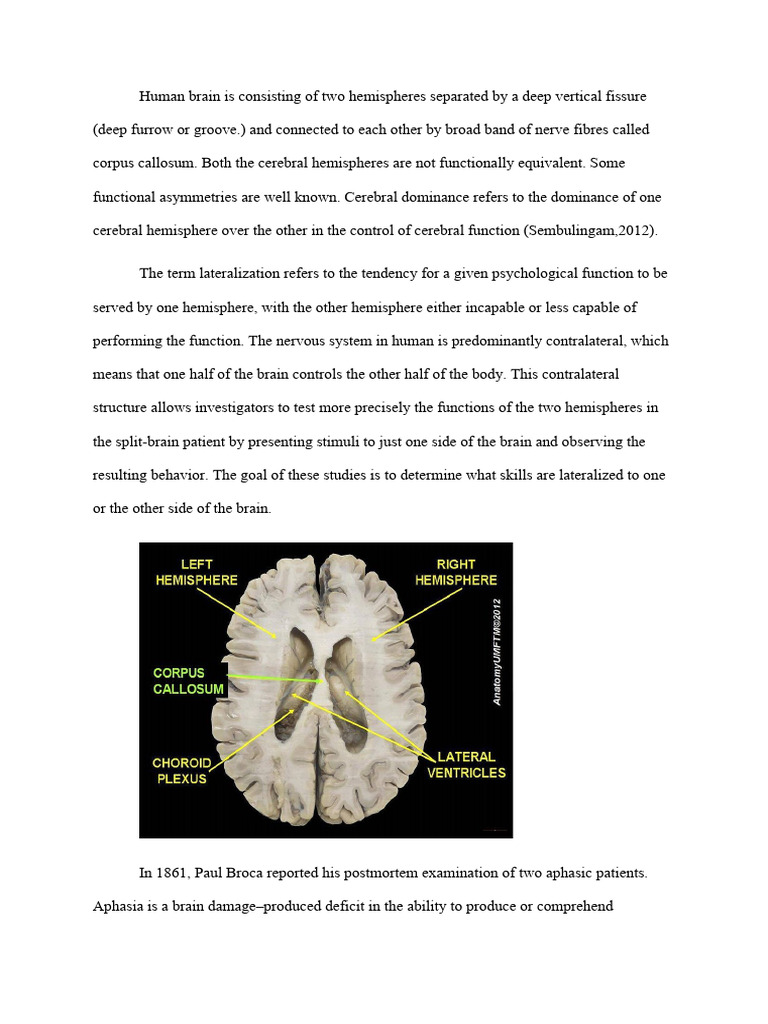 Cerebral Dominance | PDF | Lateralization Of Brain Function | Validity ...