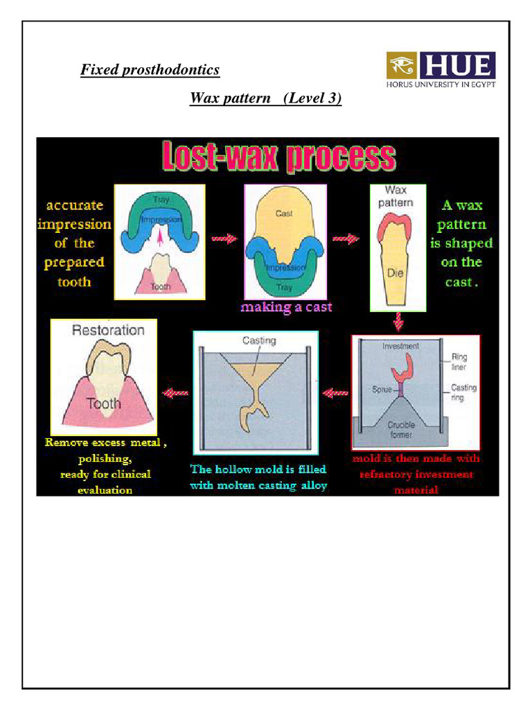 Wax Pattern Technique Level 3 HUE | PDF