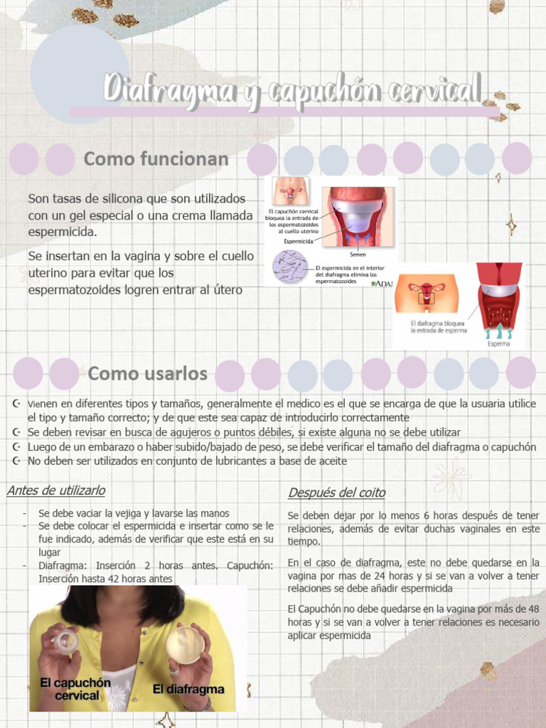 Metodos de Barrera | PDF | Condón | Vagina