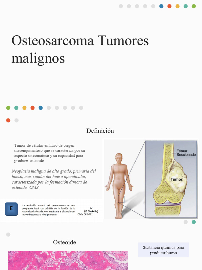 Osteosarcoma: Epidemiología y Tratamiento | PDF | Cáncer | Hueso