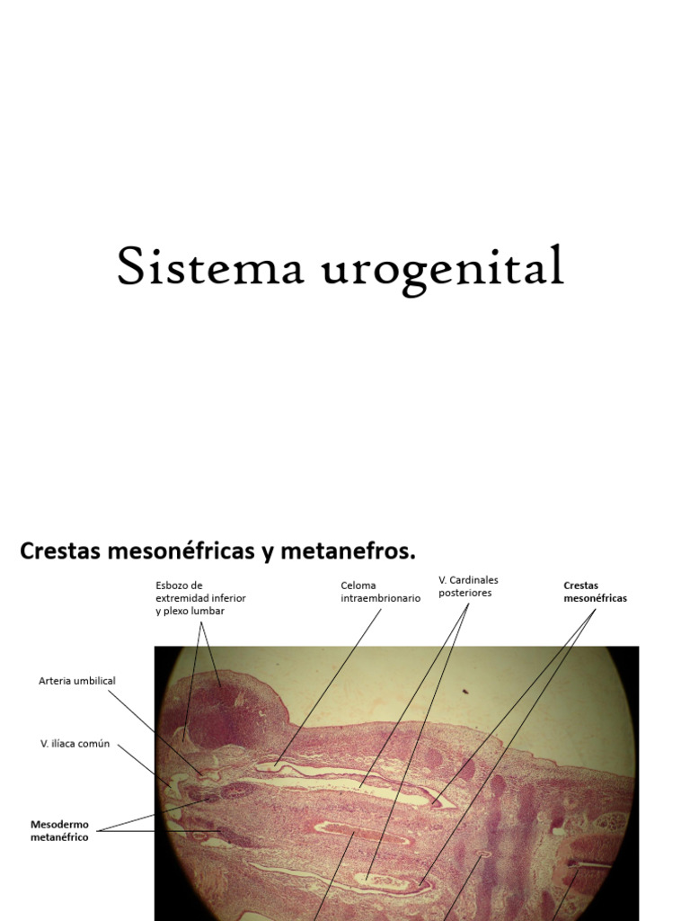 Sistema Génitourinario | PDF | Riñón | Sistema urinario