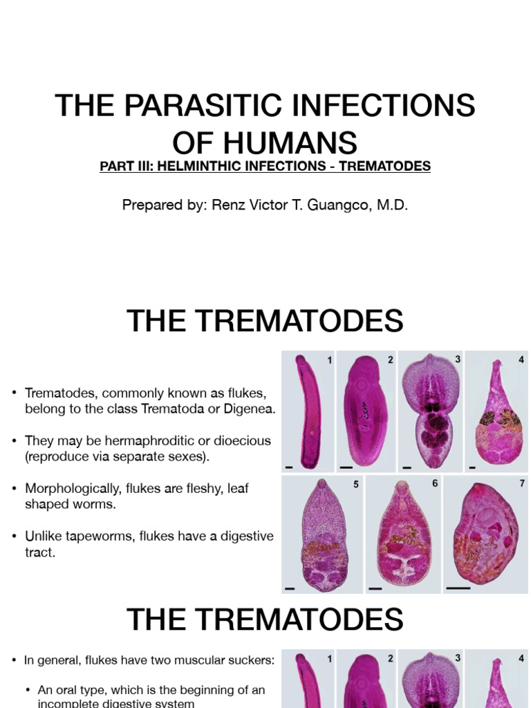 21 - The Parasitic Infections of Humans (Part 3 - Trematodes) | PDF ...