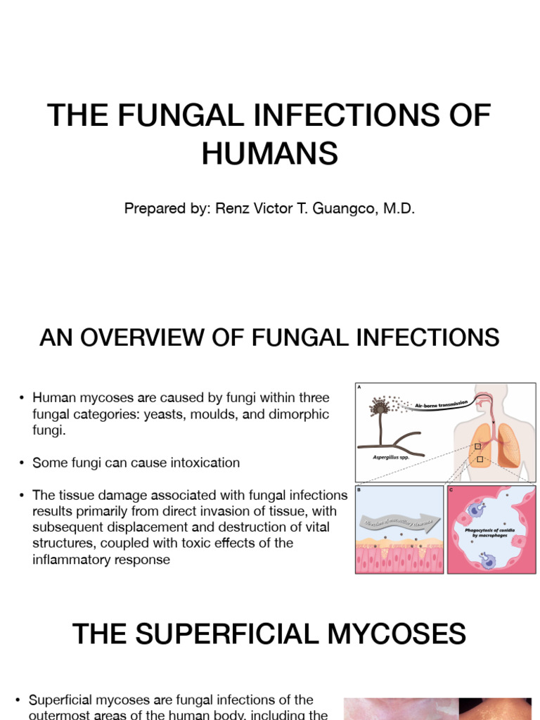 Overview of Human Fungal Infections | PDF | Candidiasis | Pneumonia