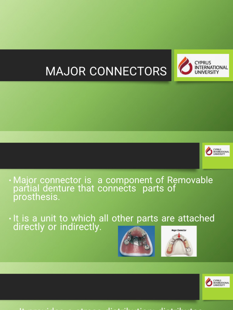 MAJOR CONNECTORS | PDF
