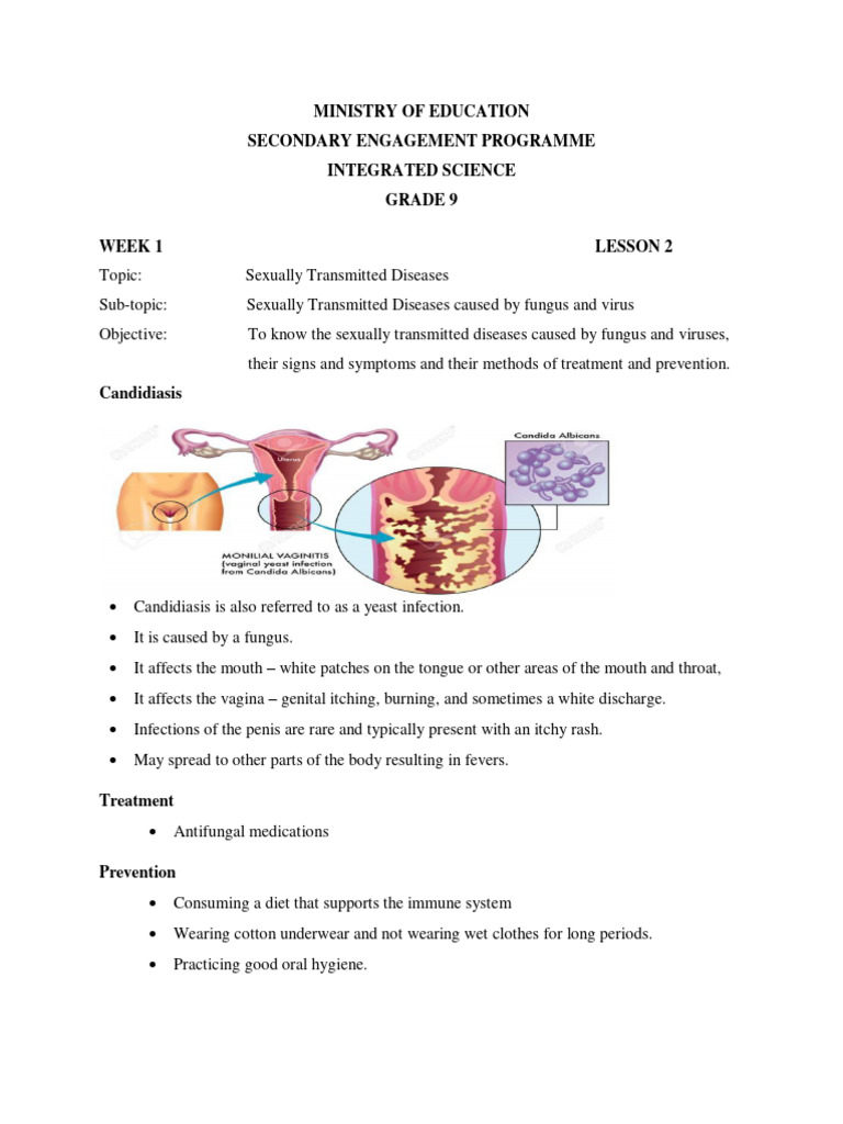 Sexually Transmitted Diseases (STD) 2 | PDF | Candidiasis | Hiv/Aids