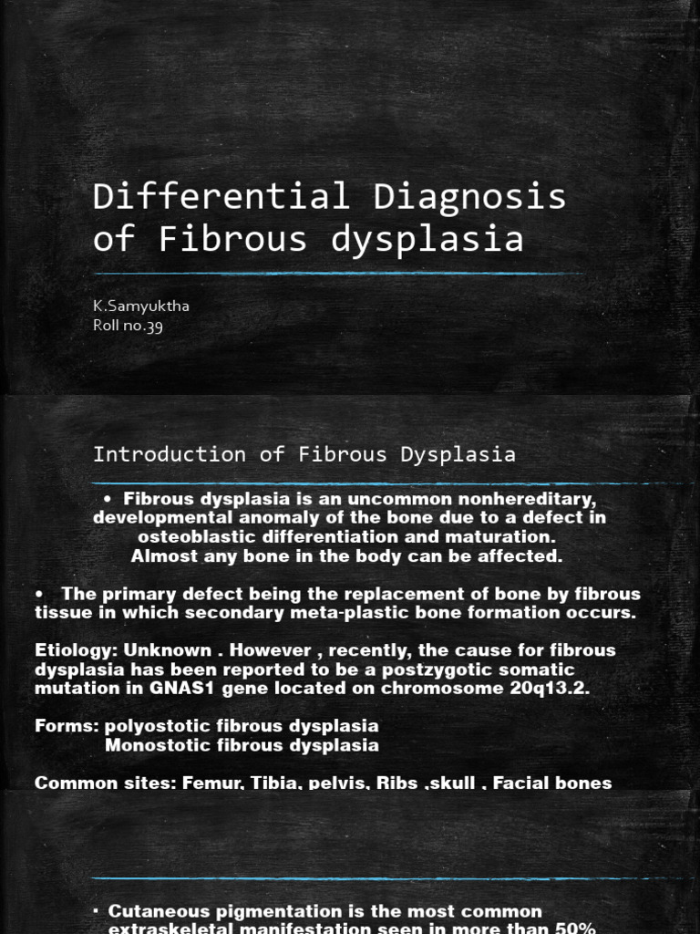 Presentation Fd Dd Pdf Metastasis Bone