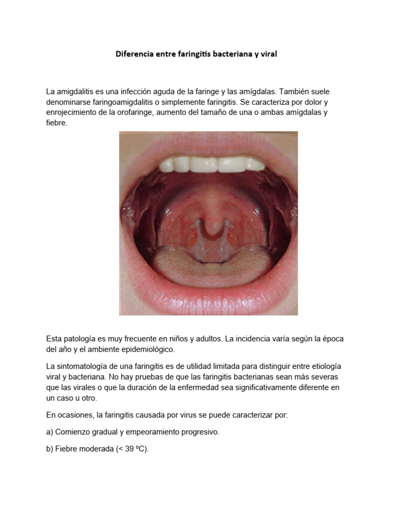 Faringitis Bacteriana y Viral | Descargar gratis PDF | Estreptococo ...