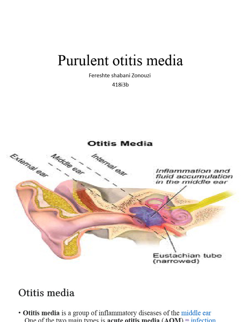 Otitis Media | PDF | Surgical Specialties | Otology