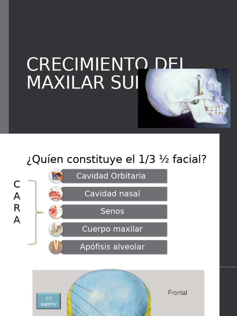 CRECIMIENTO DEL MAXILAR SUPERIOR ESQUEMA - Tagged | Descargar gratis ...