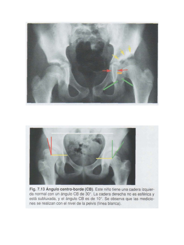 Pelvis Ap | PDF