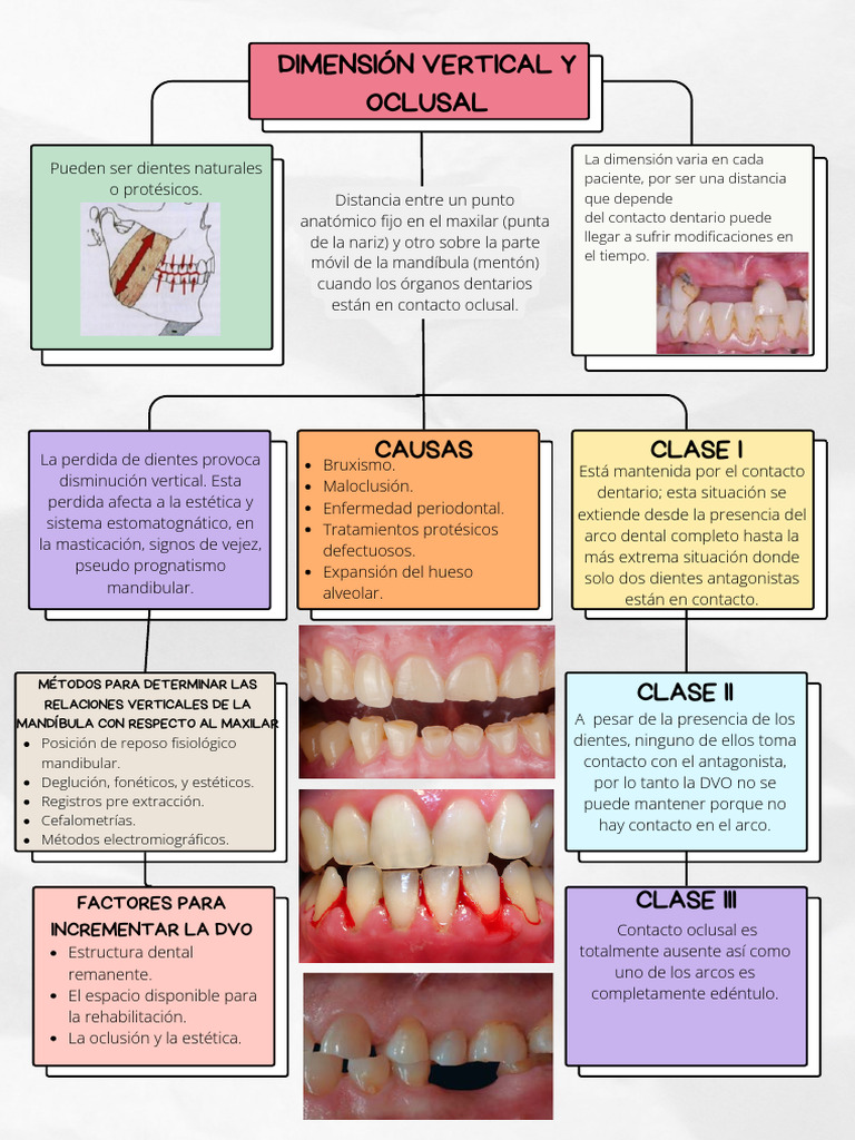 Dimensión Vertical Oclusal en Odontología | PDF | Odontología | Diente