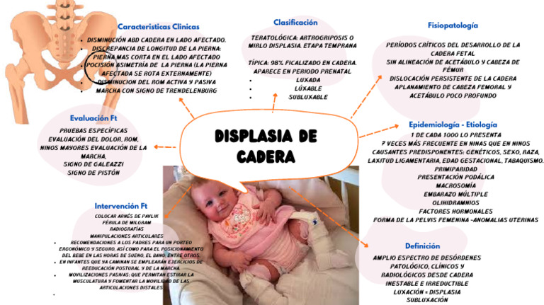 Displasia de Cadera | PDF | Medicina CLINICA | Trastornos ...