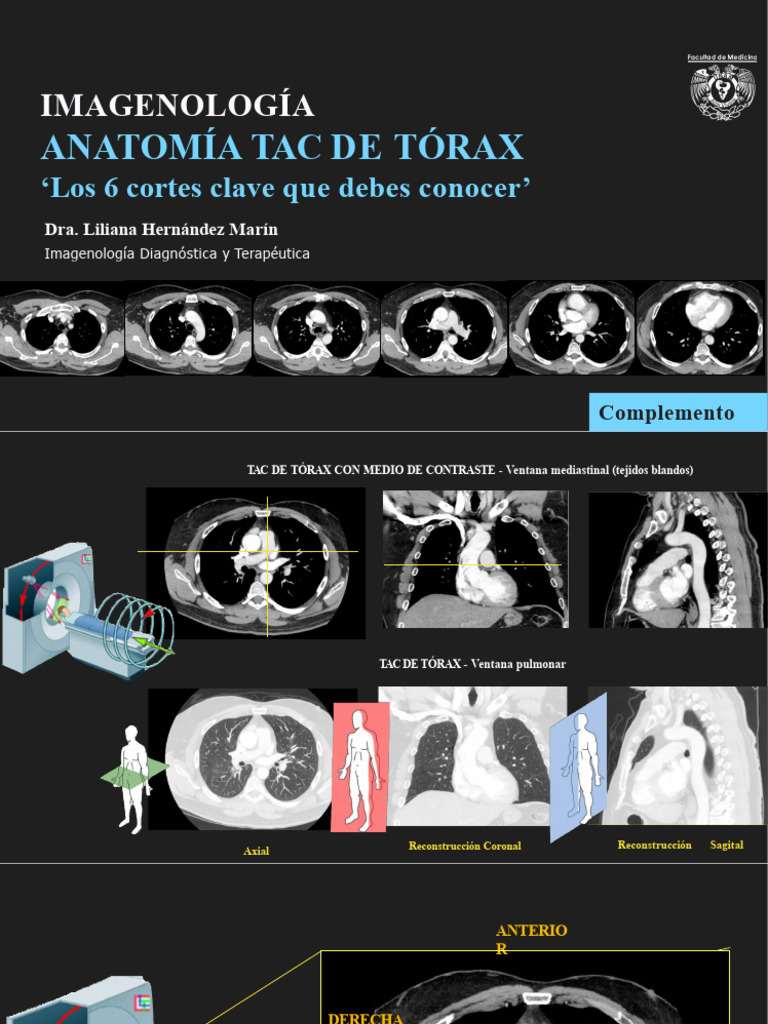 Tac de Tórax | PDF | Pulmón | Corazón