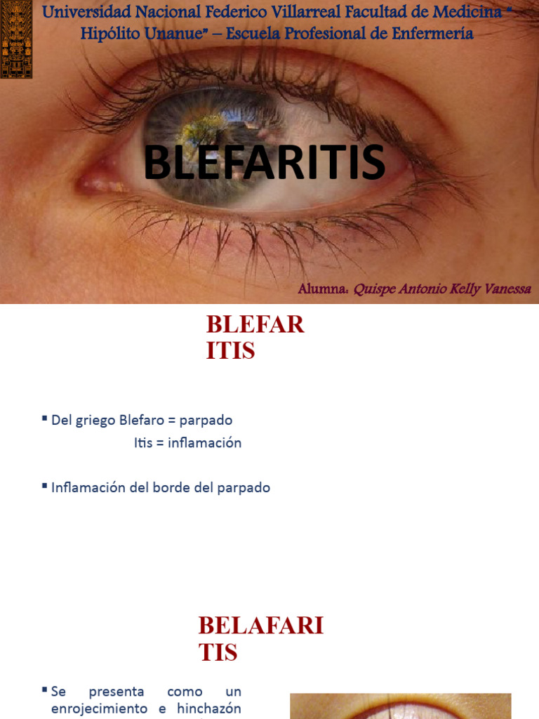 Blefaritis Diapos | Descargar gratis PDF | Enfermedades y trastornos | Especialidades Medicas