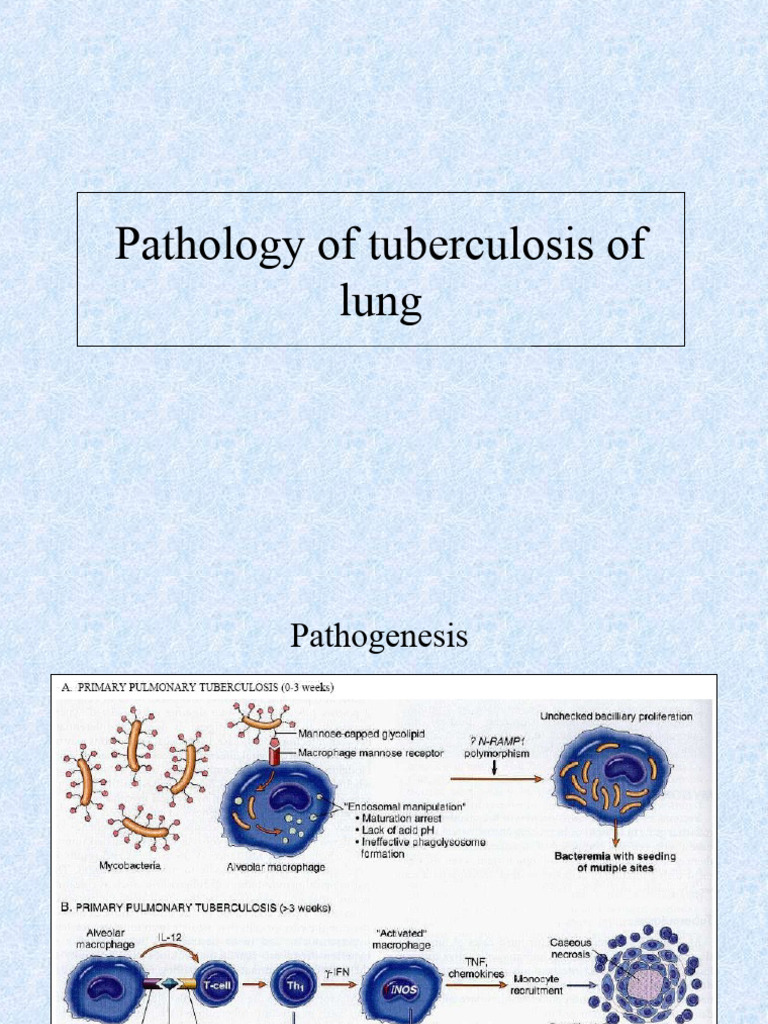 Pathology of Tuberculosis of Lung | PDF | Tuberculosis | Polymerase ...
