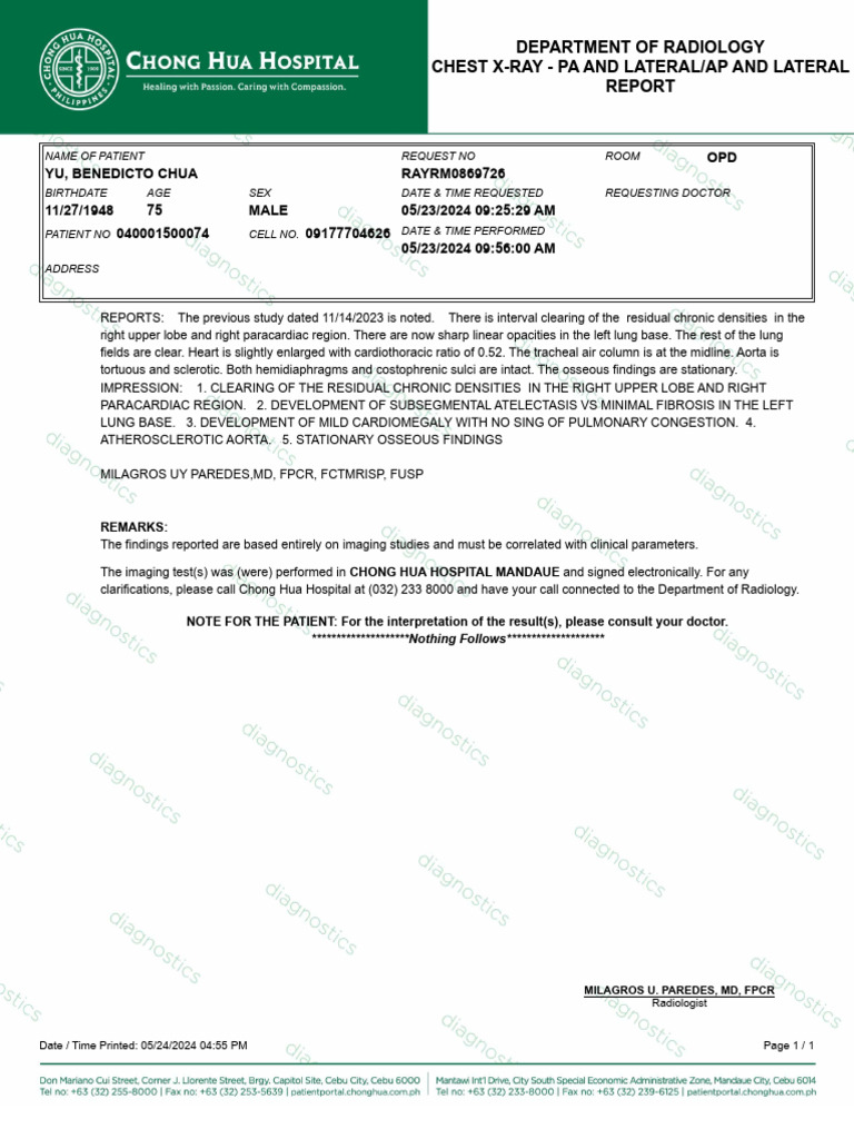 Normal Chest X-Ray Report Summary | PDF | Radiology | Lung