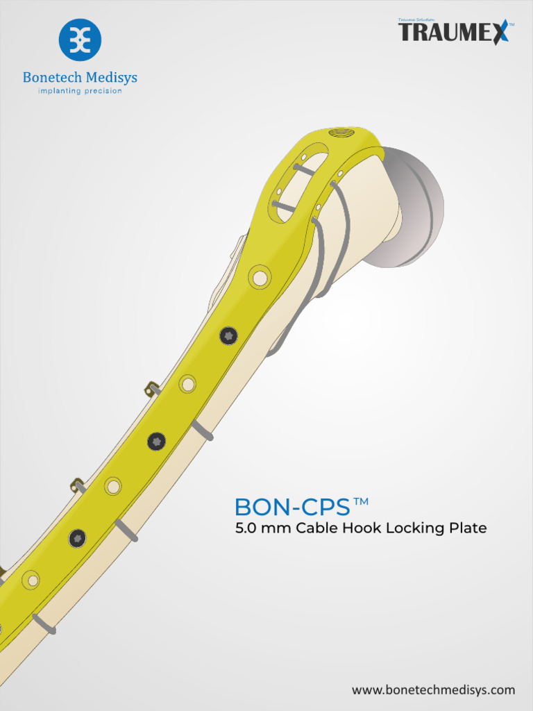 5.0 mm Cable Hook Locking Plate | PDF | Surgery | Musculoskeletal Disorders