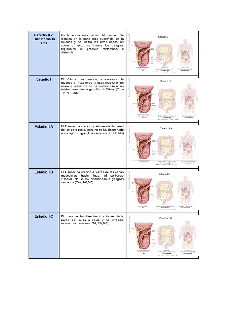 Estadios del Cáncer de Colon y Recto | PDF | Cáncer | Neoplasias