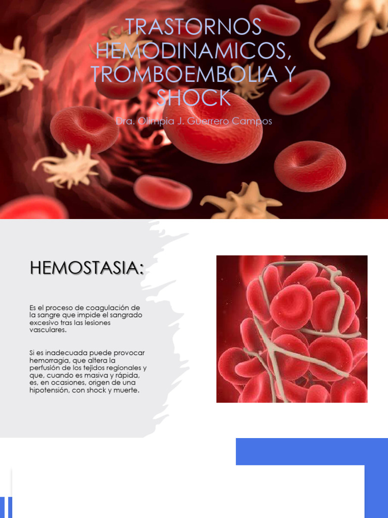 Trastornos Hemodinamicos Tromboembolia y Shock | PDF | Plaqueta | Coagulación