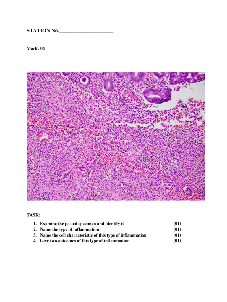 3rd Pathology Ospe PDF (1) | PDF | Inflammation | Cancer