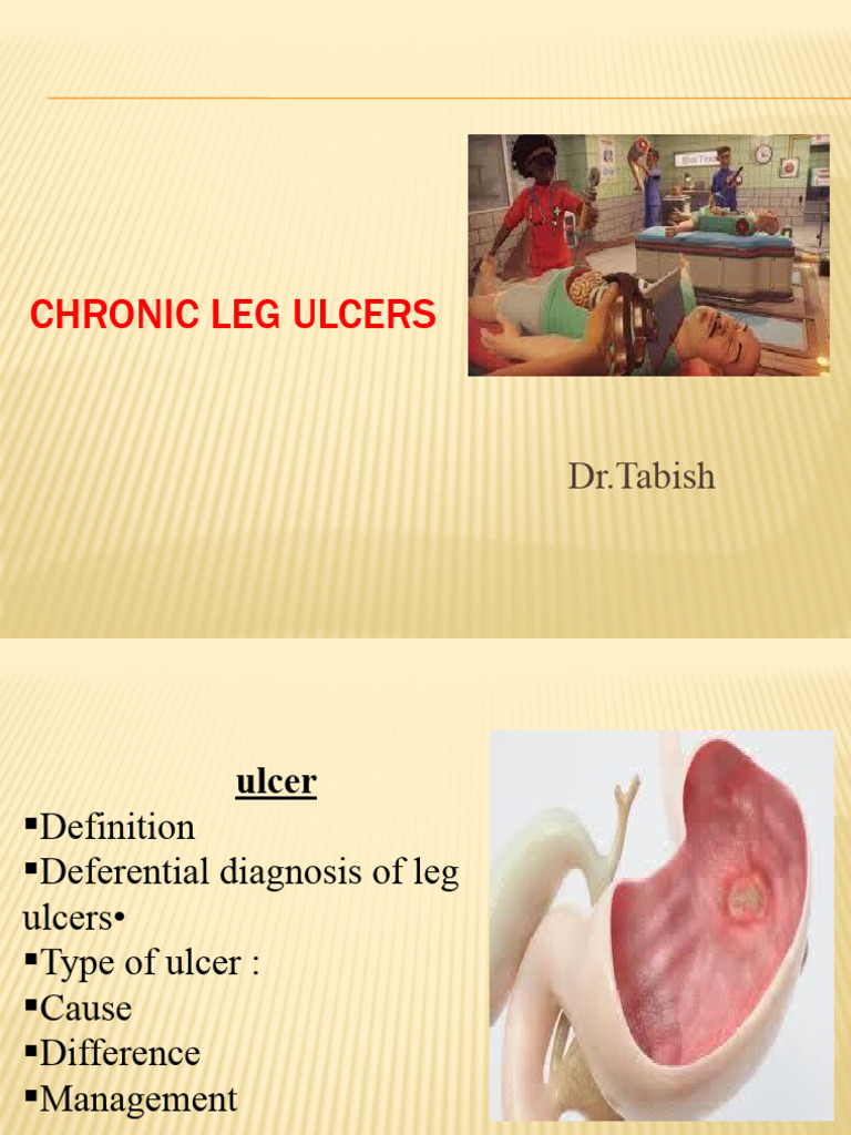 Chronic Leg Ulcer 1 | PDF | Vein | Thrombosis
