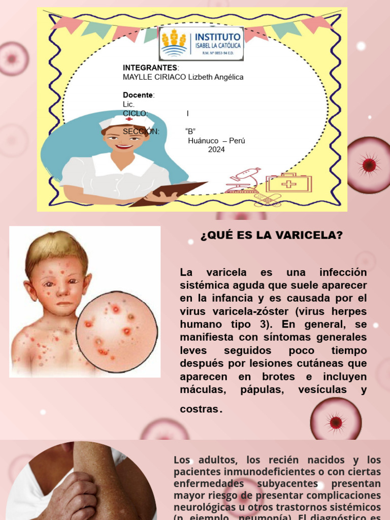 Varicela: Síntomas, Diagnóstico y Prevención | PDF | Virus | Causas de ...