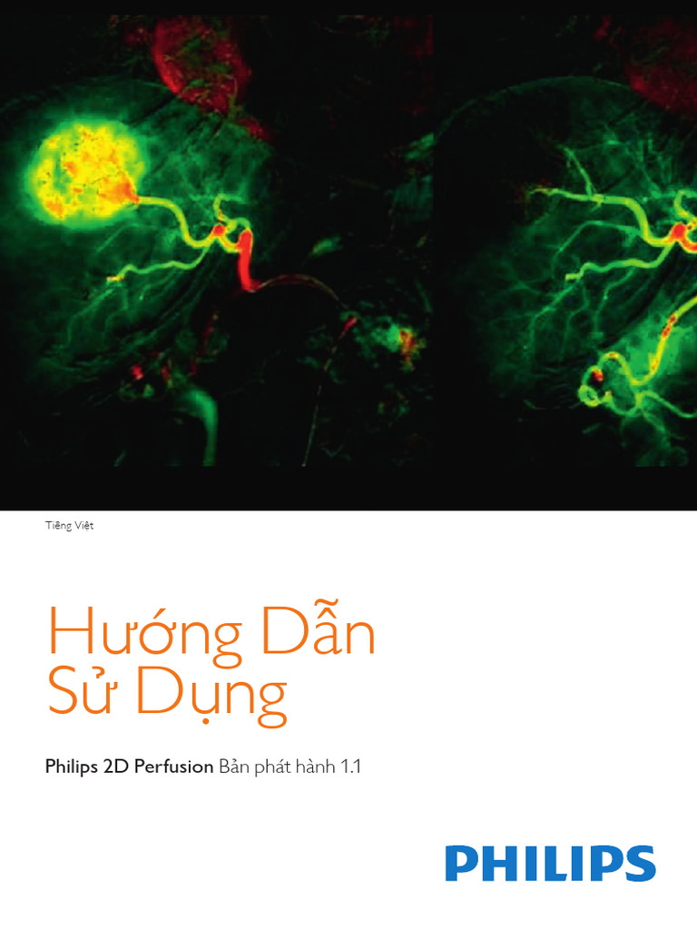 4522 203 50601 Vi | PDF