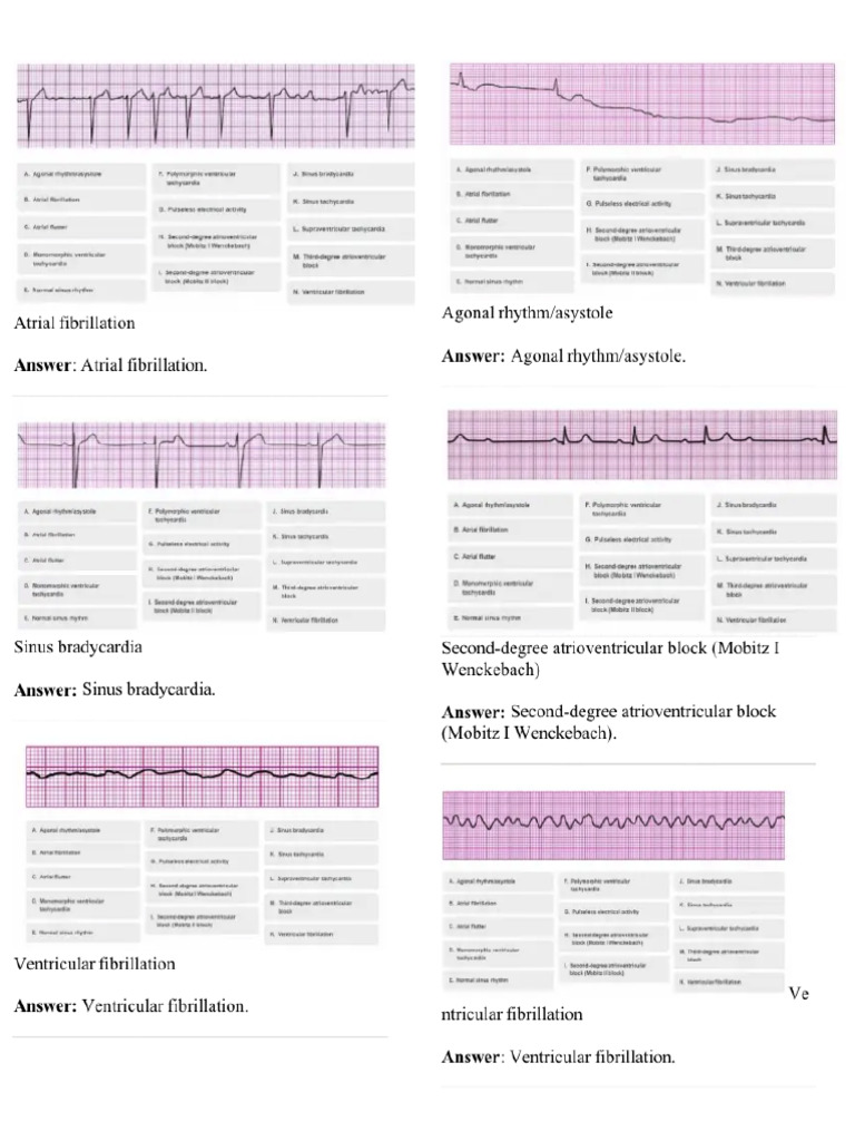 ACLS Pre Test Answers2 | PDF
